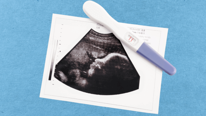 The Rise of Pronatalism in the U.S.: The Risks to Reproductive and ...